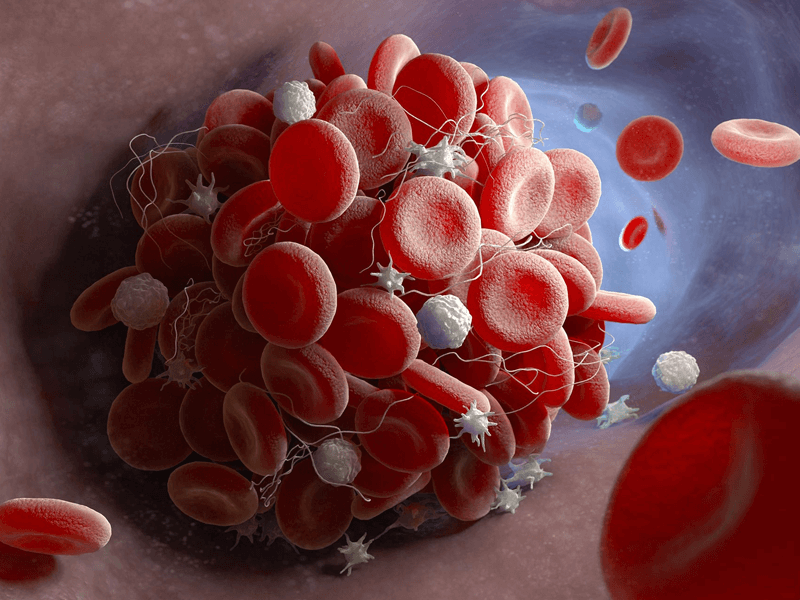 Tromboza i ishrana - Mina Simonović